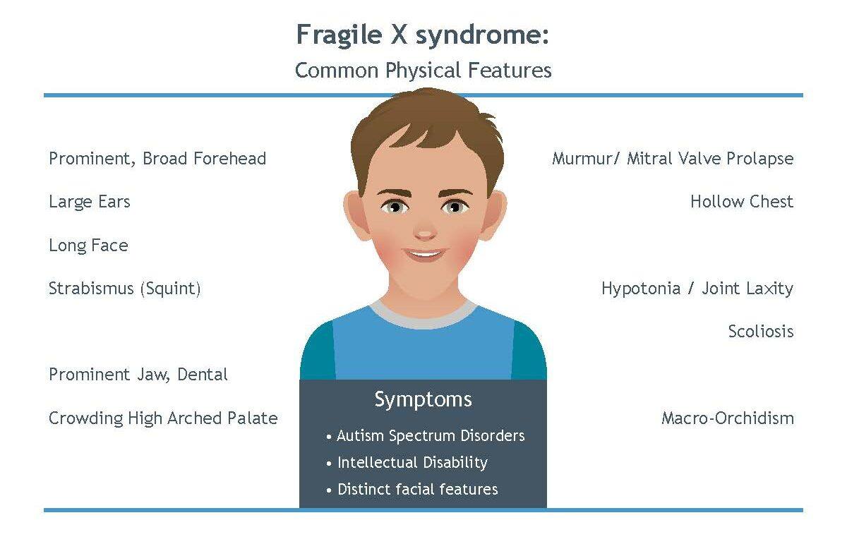 What Is Fragile X Why Does It Have That Name Deals Dakora co