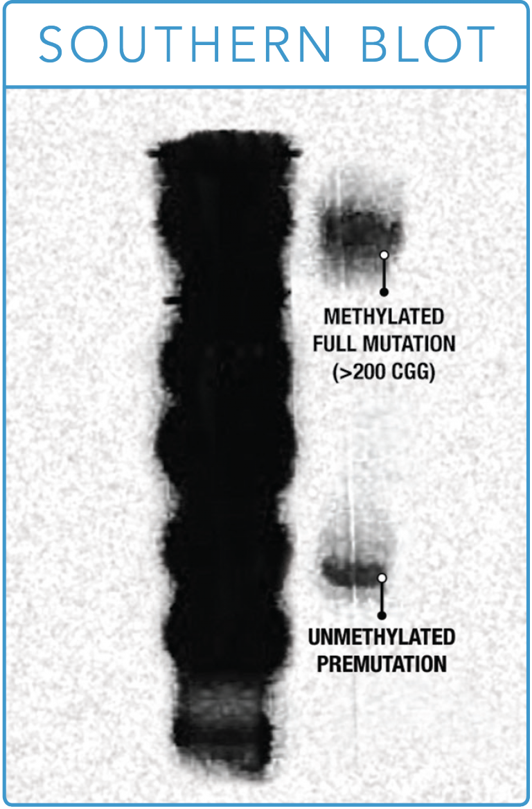 FMR1 Gene Detection | AmplideX® mPCR FMR1 Kit | Asuragen
