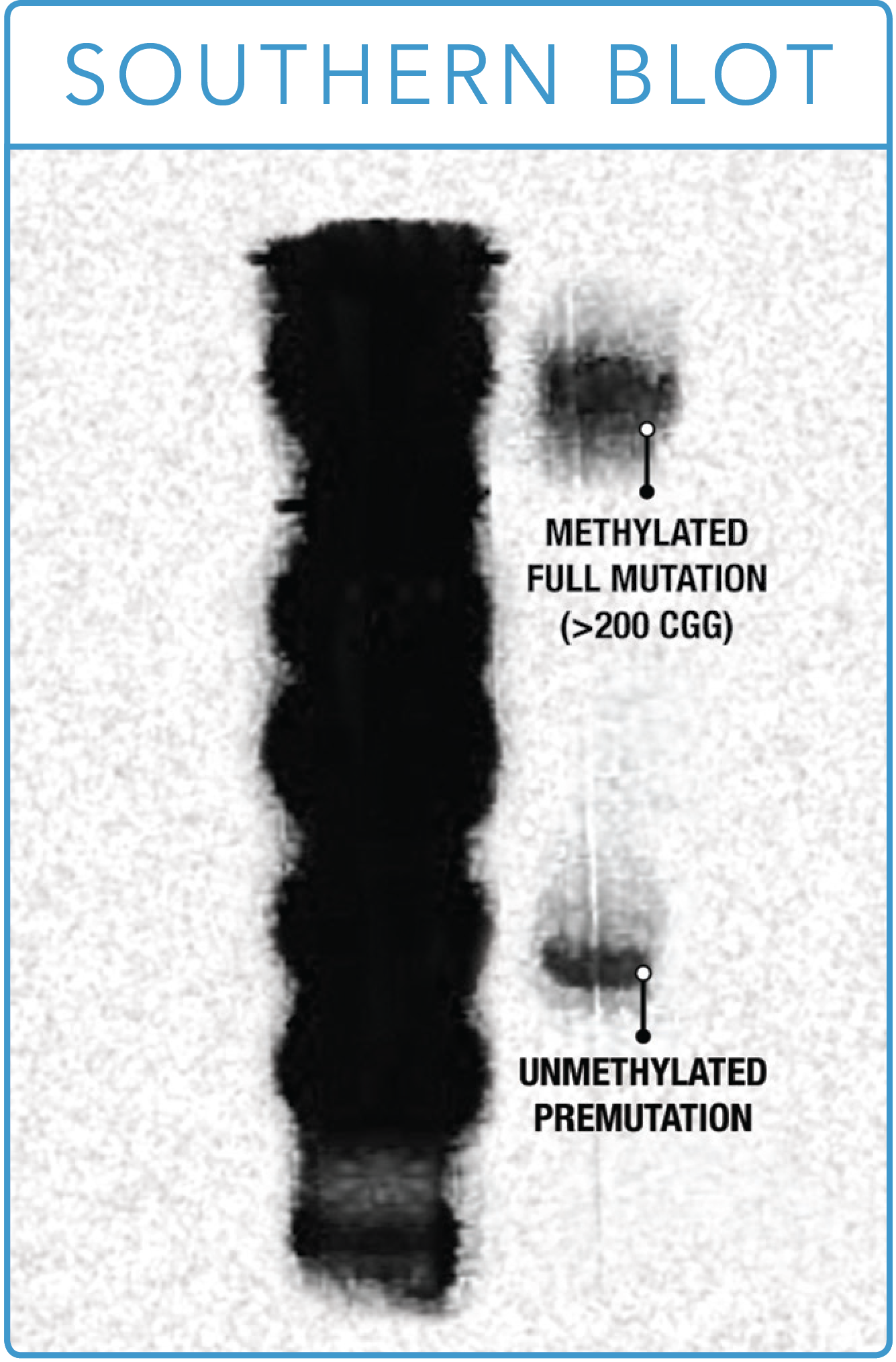 FMR1 Gene Detection | AmplideX® mPCR FMR1 Kit | Asuragen